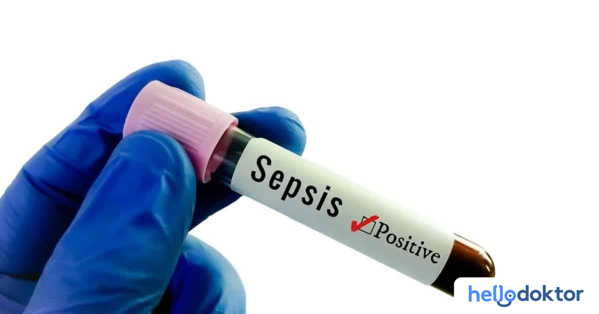 Simptom Sepsis: Ini Penjelasan Apa Itu Sepsis dan Tanda-Tandanya!