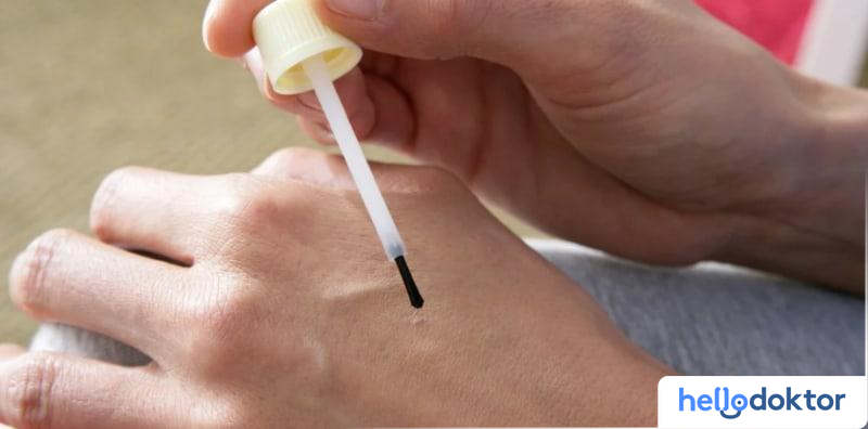 Punca Kutil Tumbuh Di Badan: Ketahui Simptm & Cara Mengatasinya!