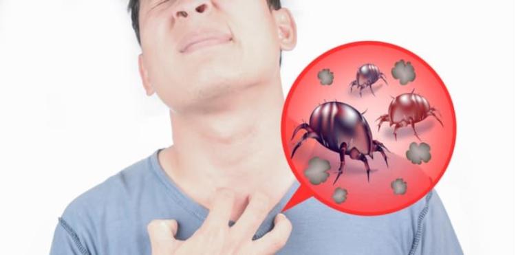 Alahan Hama: Simptom, Punca, Diagnosis Dan Rawatan - Hello Doktor