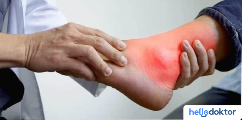 Pesakit Gout: Ini 5 Tips Berkesan Untuk Kurangkan Sakit