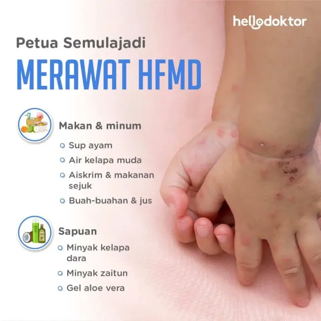 Spray Mulut HFMD, Berkesen Ke? Ini Jawapan KKM Dulu! - Hello Doktor