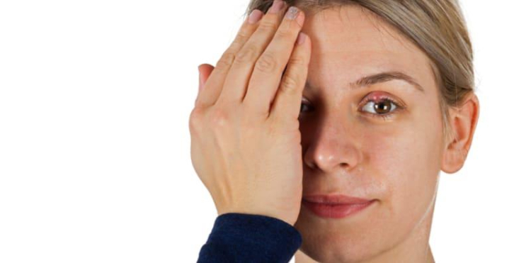 Ketumbit Mata Muncul? Bahaya, Usah Biar! Ada 2 Jenis Boleh Buat Buta!