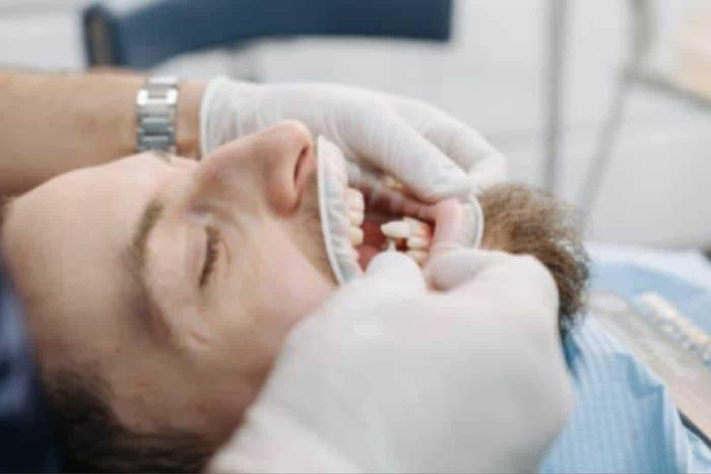 Tampal Gigi: Apa Yang Anda Perlu Lakukan Untuk Elak Tampalan Pecah?