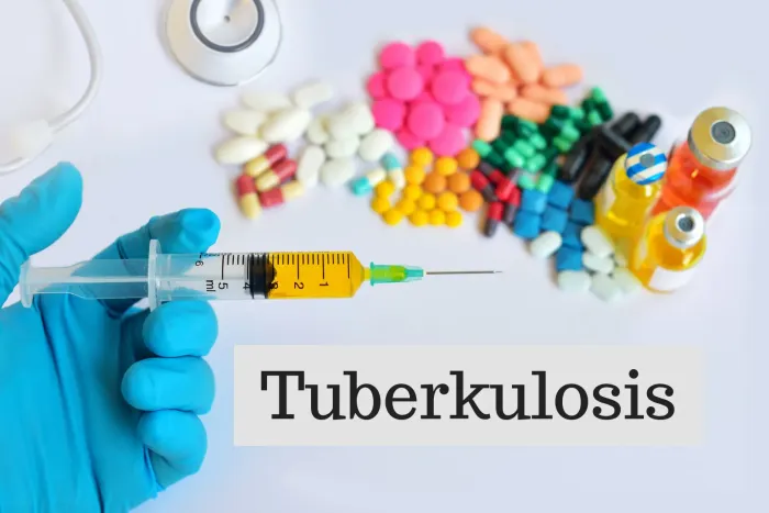 Sakit Tuberkulosis - Ambil Tahu Simptom & Bagaimana Ia Boleh Dijangkiti