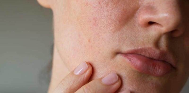 Fungsi Kulit & Struktur Kulit, Apa Yang Individu Perlu Tahu Tentangnya?