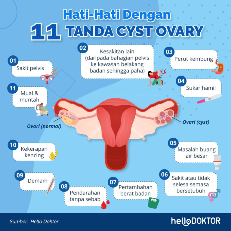 Sakit Perut Sebelah Kanan Bawah: Ini Mungkin Disebabkan 6 Penyakit