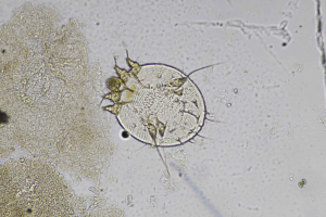 Kudis Buta: Memahami Jangkitan Kutu Sarcoptes Scabiei - Hello Doktor