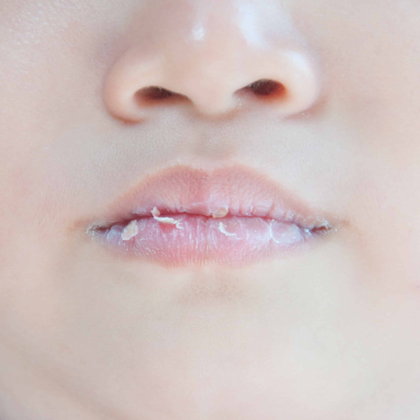 Bibir dan Penjagaannya yang Boleh Diamalkan - Hello Doktor