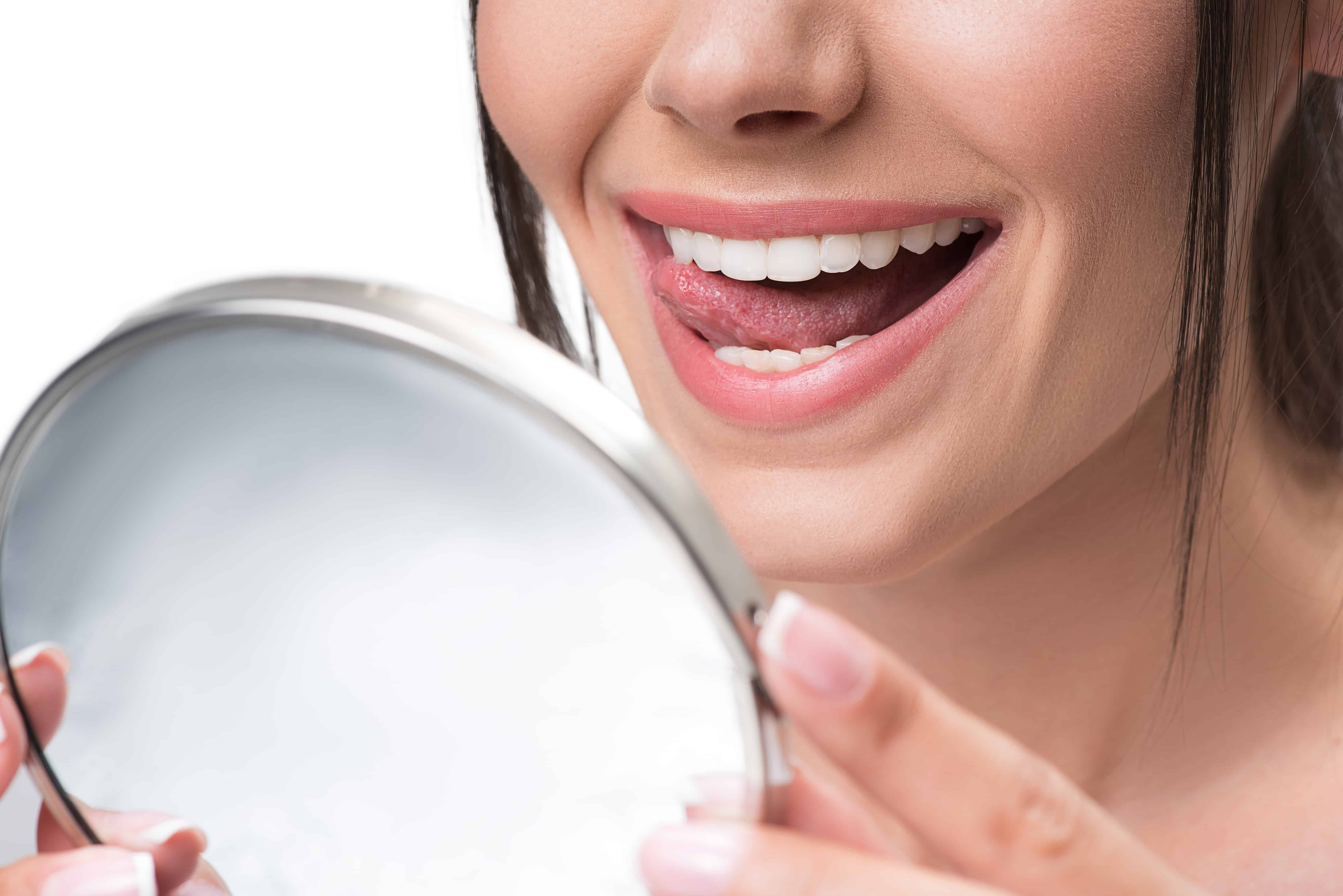 Kesihatan Gigi Dan Mulut Mesti Dijaga Dengan Baik Dan Sempurna