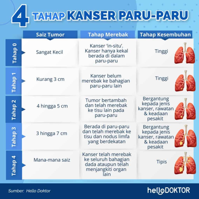 Kesan Merokok Tidak Bergantung Pada Jumlah Rokok - Hello Doktor
