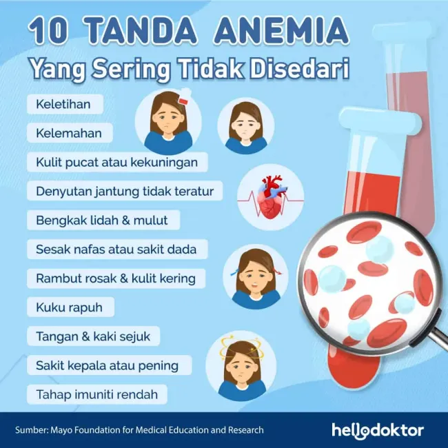 Simptom Anemia: Ketahui Tanda & Cara Rawatan Bagi Mengatasinya