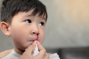 Punca Hidung Berdarah Bukan Sebab Ghairah! Ini Sebab Sebenarnya