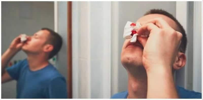 Punca Hidung Berdarah Bukan Sebab Ghairah! Ini Sebab Sebenarnya