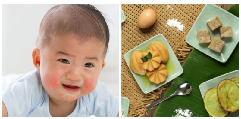 Alergi Protein Telur Pada Si Manja? Ibu Ayah, Kenal Pasti 12 Simptom Ini!