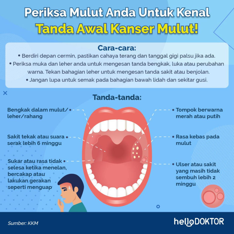 Ketulan Di Leher Petanda Kanser Kepala Dan Leher? Betul Ke?