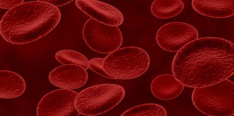 Anemia Sel Sabit: Pesakit Hanya Boleh Hidup Sampai Usia 40-an?