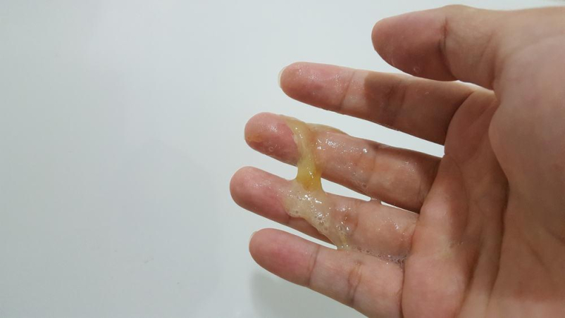 Bagaimana Hingus Terhasil? Ini Rahsia Di Sebalik 7 Warna Hingus!