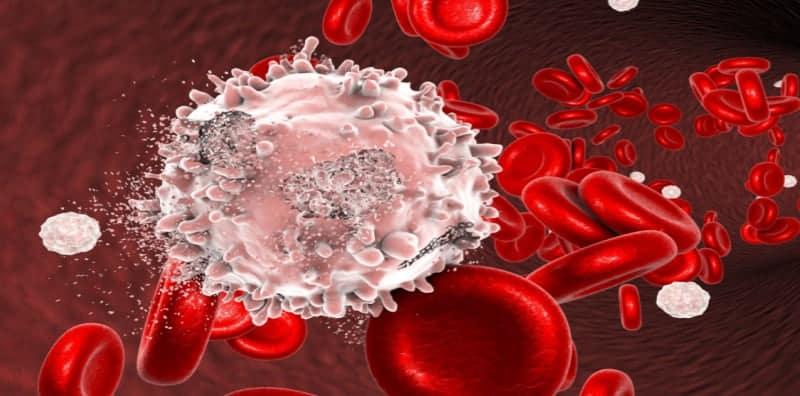 Jenis Kanser Darah: Apa Beza Leukemia dan Limfoma? - Hello Doktor