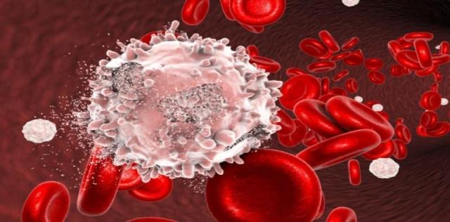 Jenis Kanser Darah: Apa Beza Leukemia dan Limfoma? - Hello Doktor