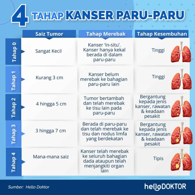 Pemeriksaan Paru Paru Ini Penting Untuk Diagnosis Kanser - Hello Doktor