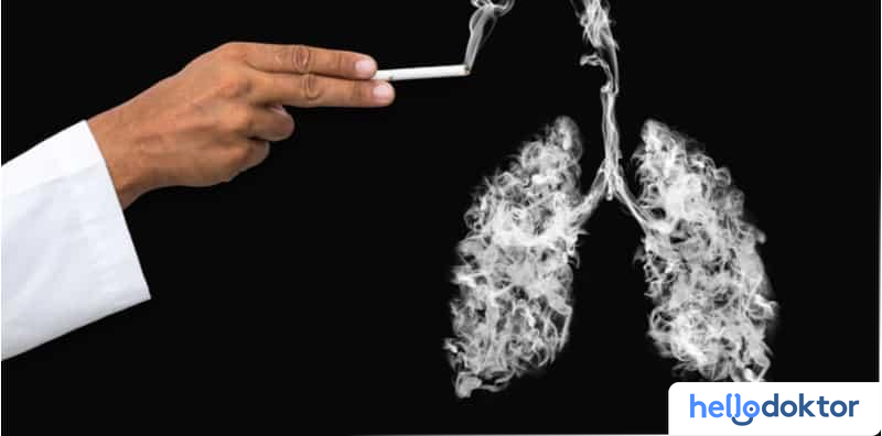 Pemeriksaan Paru Paru Ini Penting Untuk Diagnosis Kanser - Hello Doktor