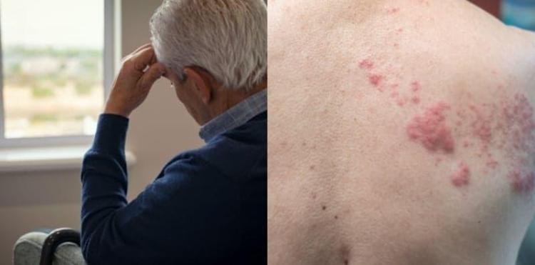 Penyakit Kayap: Mengapa Warga Emas Lebih Mudah Dijangkiti?