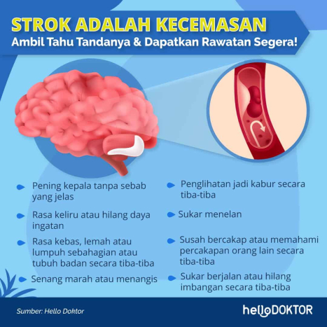 Penyakit Strok: Apa Yang Perlu Anda Ketahui, Info Lengkap Di Sini