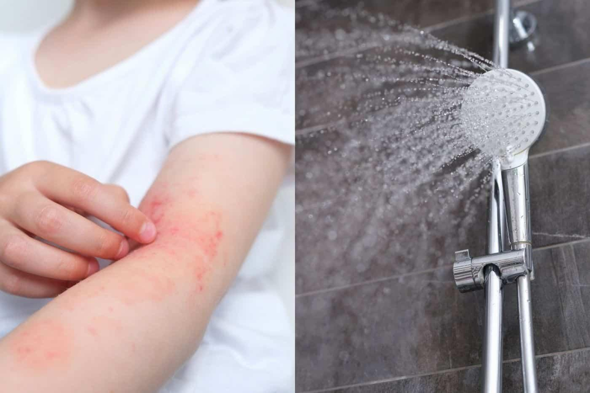 Bintik Merah Pada Kulit? Ini 7 Sebab Kenapa Kulit Anda Alami Masalah!