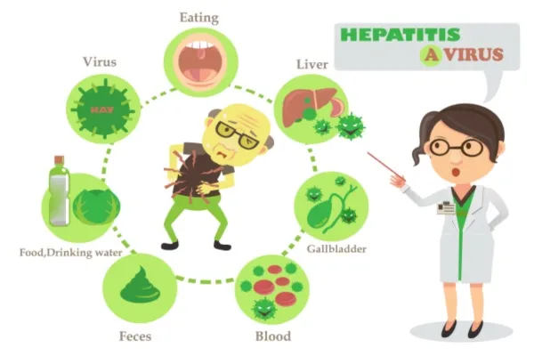 Apa Itu Hepatitis A: Ini Golongan Paling Berisiko Menghidapinya!