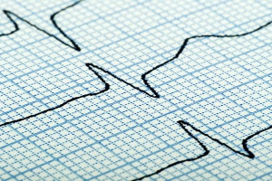Jantung Berdegup Laju, Bagaimana Hendak Mengatasinya? - Hello Doktor
