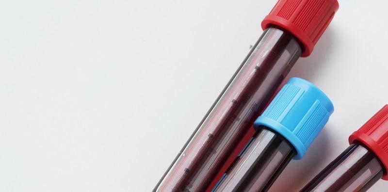 Penyakit Darah: Ini Jenis-jenisnya Yang Perlu Diketahui - Hello Doktor