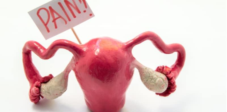 Rawatan PCOS & Kaedah Mengurus Gejala Yang Perlu Pesakit Amalkan