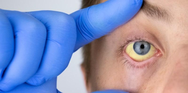 Apa Itu Hepatitis? Ini ABC Hepatitis Yang Anda Perlu Tahu! - Hello Doktor