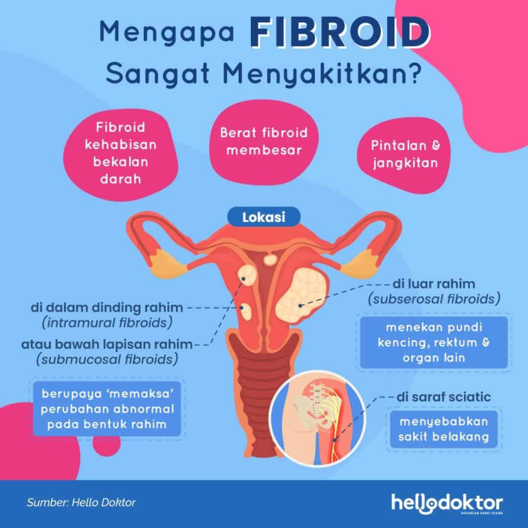 Pembedahan Fibroid @ Makan Ubat? Ketahui Pilihan Rawatan Yang Ada!