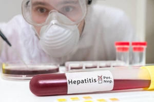 Jangkitan Hepatitis B: Info Lengkap Mengenai Simptom, Punca & Rawatan