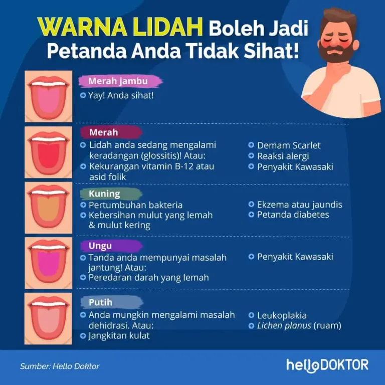 Warna Lidah Normal Bagaimana? Ini Cara Untuk Jaga Kesihatan Lidah