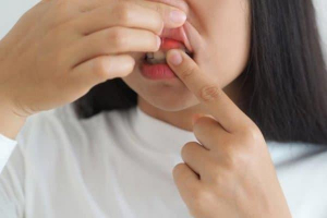 Tumor Gusi & Tumor Gigi, Apa Beza Antara 2 Jenis Ketumbuhan Mulut Ini?