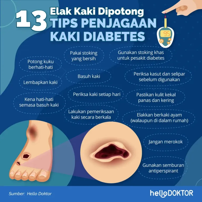 Tanda Tanda Diabetes Pada Kaki: Buat Ujian Ini Untuk Kesan Kaki Kebas!