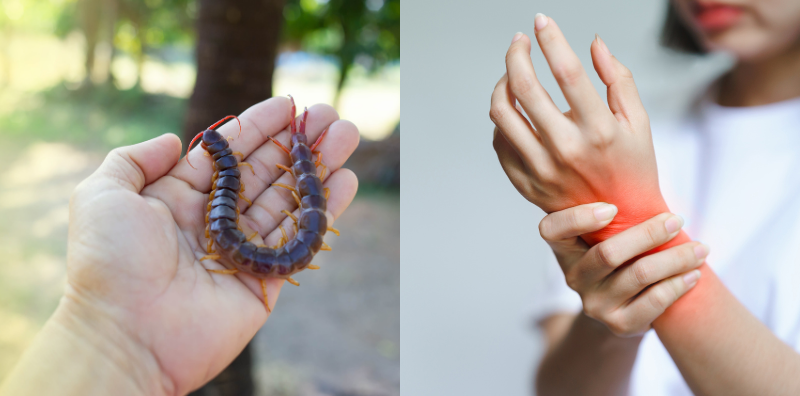 Kesan Gigitan Lipan, Apa Yang Perlu Anda Buat Jika Ia Terjadi Di Rumah?