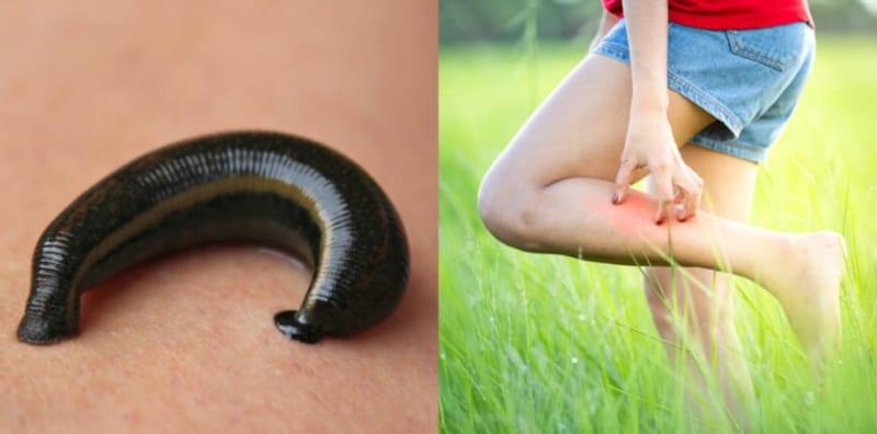 Gigi Pacat Itu Bahaya, Rawatan Gigitan Haiwan Ini Yang Anda Perlu Tahu!