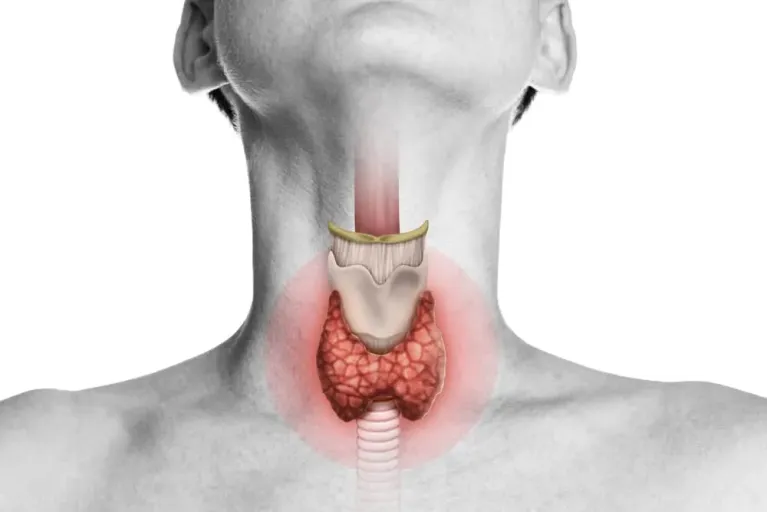 10 Tanda Thyroid Rendah Penyebab Hipotiroidisme Boleh Berlaku, AWAS!