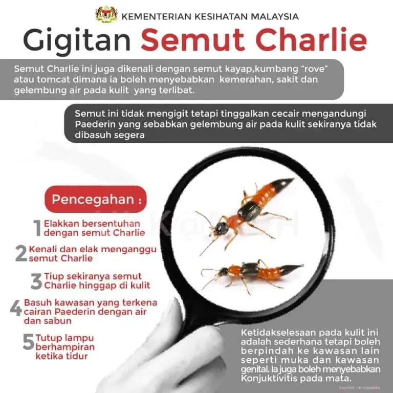 Semut Charlie Ada Bisa Yang Bahaya! Kalau Kena Gigit, Buat 5 Cara Ini!