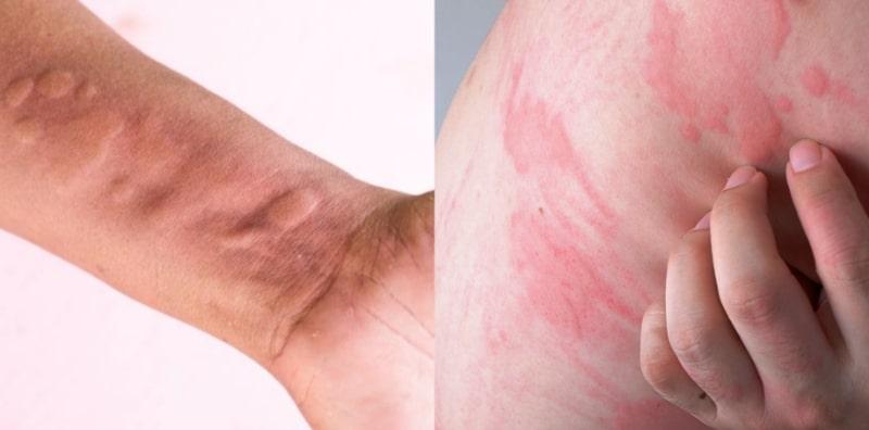 Pantang Larang Sopak Garam: Ketahui 7 Perkara Yang Anda Mesti Elak!