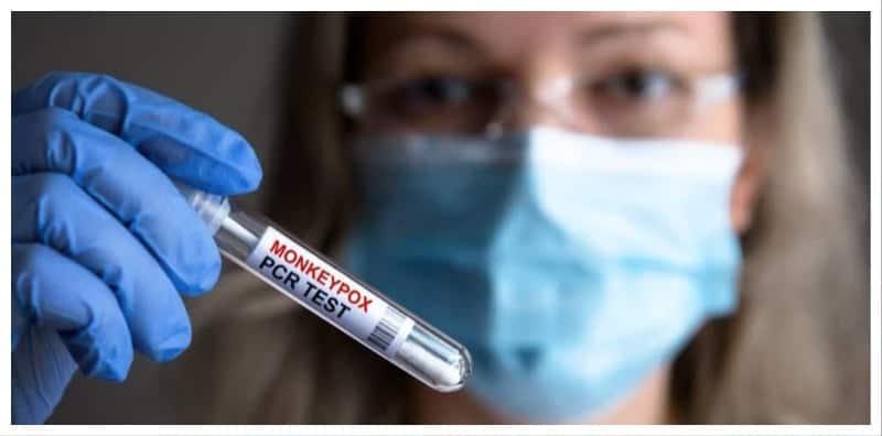 Simptom Monkeypox: Apa Bezanya Dengan Cacar Biasa? - Hello Doktor