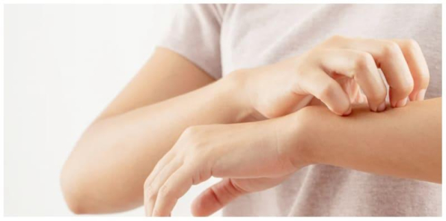 Ubat Gatal Kulit Paling Berkesan: Beli 3 Jenis Ubat Ini Di Farmasi!