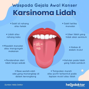 Ulser Lidah: Selain Kurang Minum Air Kosong, Apa Punca Kondisi Ini?