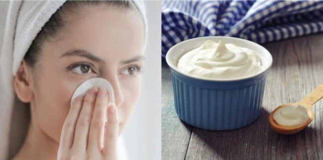 Cara Hilangkan Panau Di Muka Moden VS Tradisional, Mana Lebih Baik?