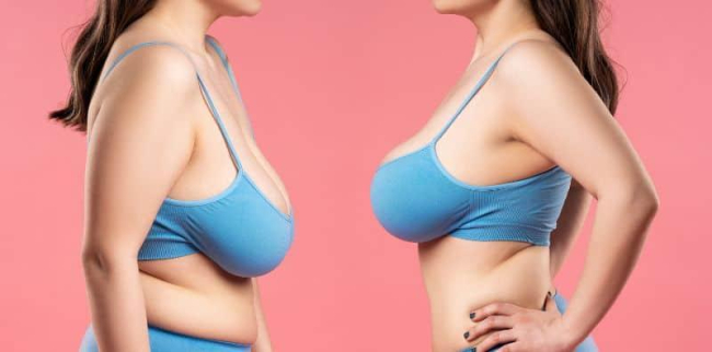 Payudara Kendur? Ini 5 Punca Buah Dada 'Melendut' Sebelum Masa!