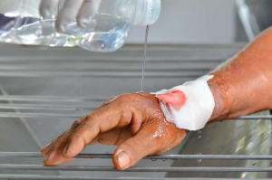 Air Cuci Luka Untuk Apa? Ini Manfaat & Cara Buat Air Saline Di Rumah!