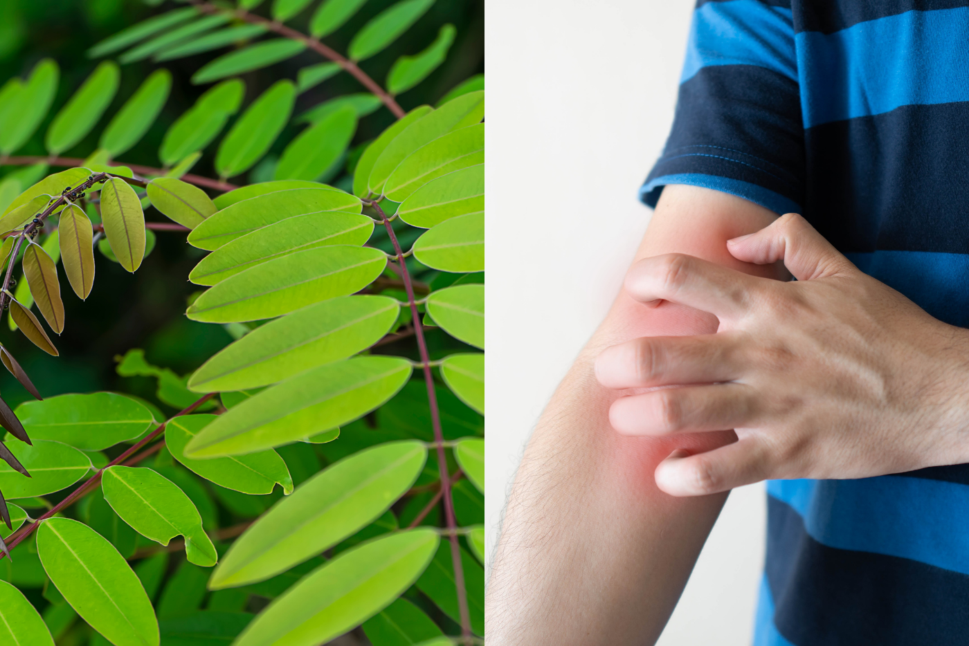 Daun Gelenggang Boleh Rawat Kurap! Ada 5 Lagi Khasiat Daun Ini